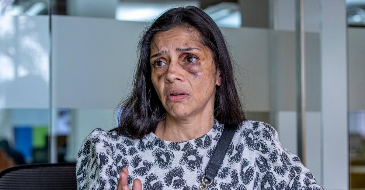 Cara y sello de una historia de violencia intrafamiliar Cara y sello de una historia de violencia intrafamiliar