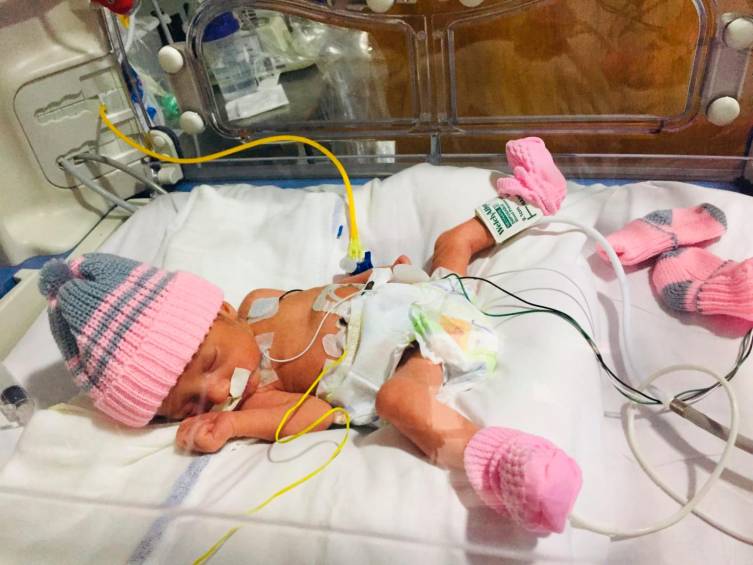 15 millones de bebés en el mundo nacen antes de tiempo