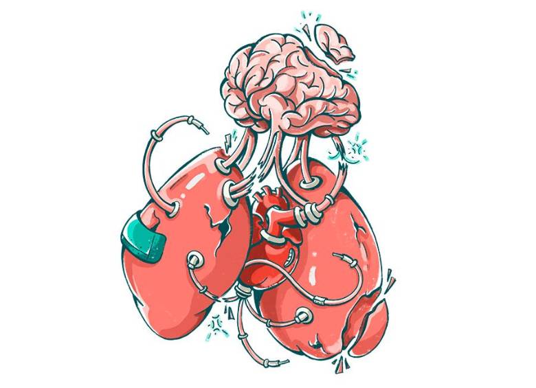 Paro cardíaco, ¿qué es y cómo evitarlo?