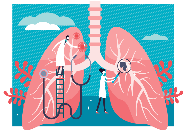 Cáncer de pulmón: claves para entenderlo