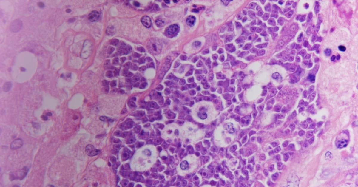 Biografía de un gusano cancerígeno