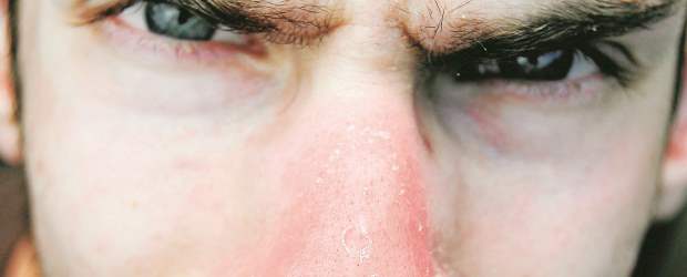 Tener la piel roja no es para sonrojarse