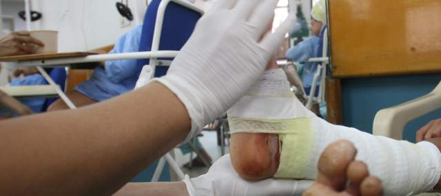 “Cifras de quemados son alarmantes”: